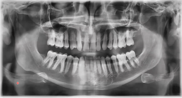 CDOCS Resources - Survey